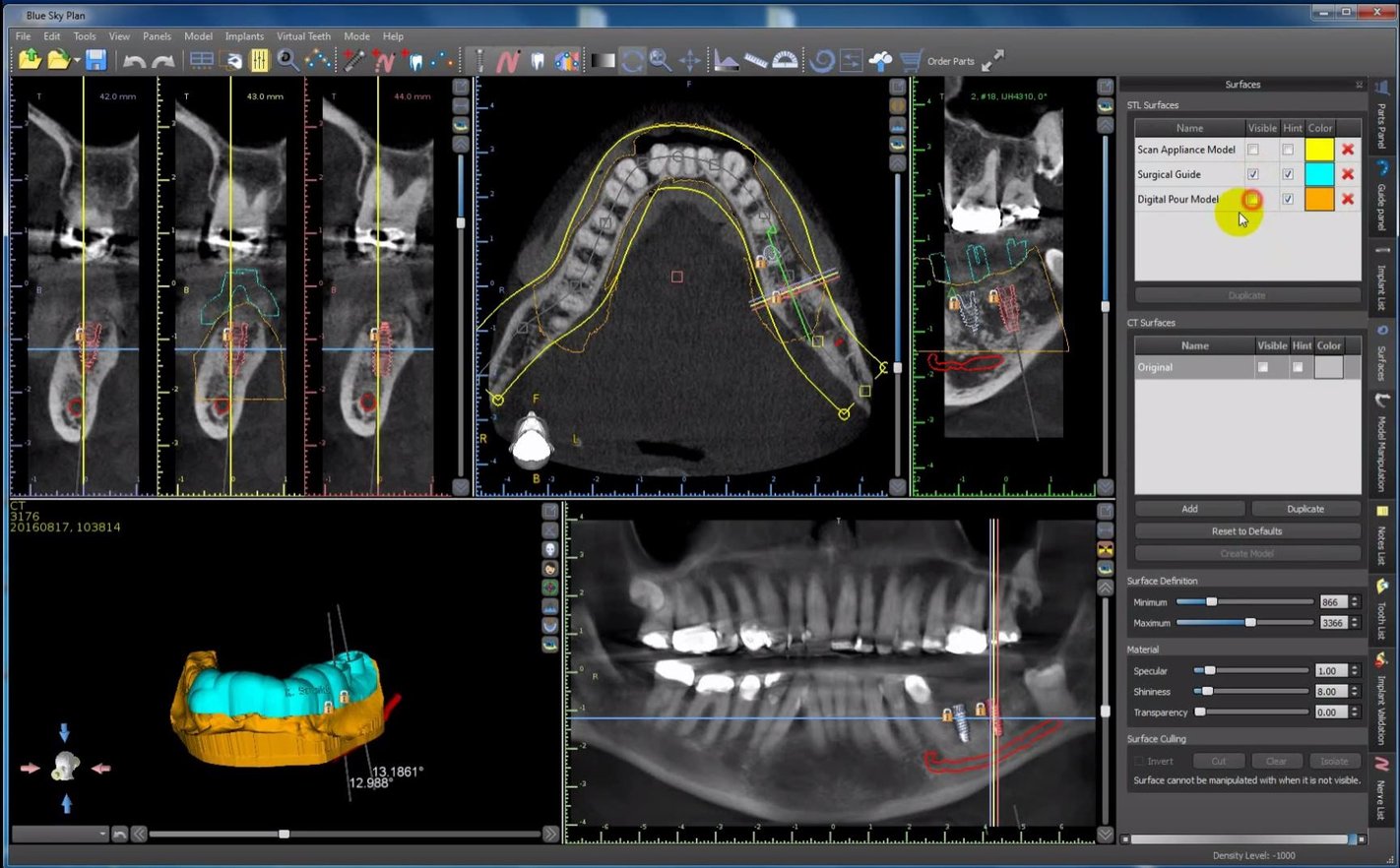 Creating a Surgical Guide with your CBCT