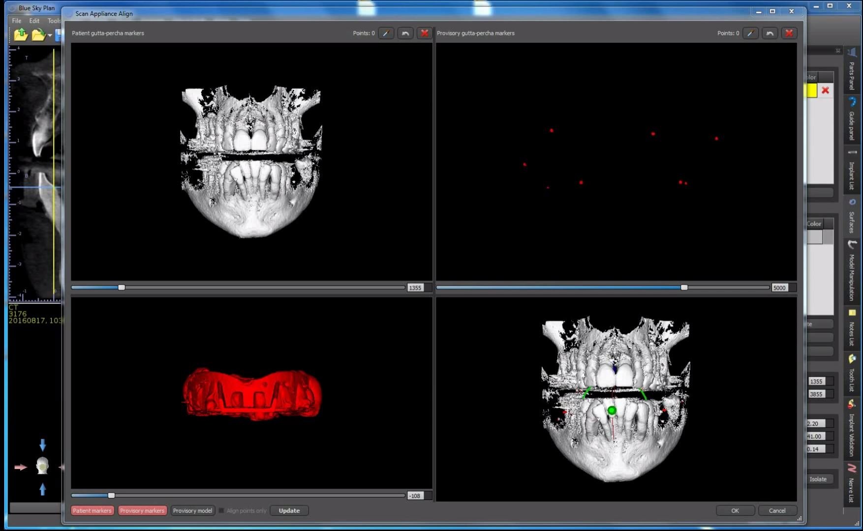 Creating a Surgical Guide with your CBCT