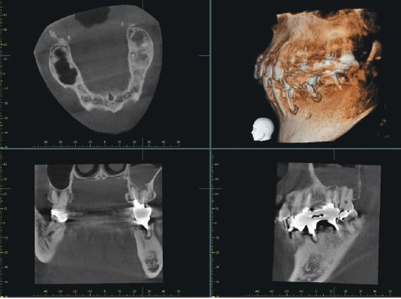 Comprehensive CBCT Training is Crucial, Here's Why