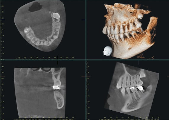 Comprehensive CBCT Training is Crucial, Here's Why