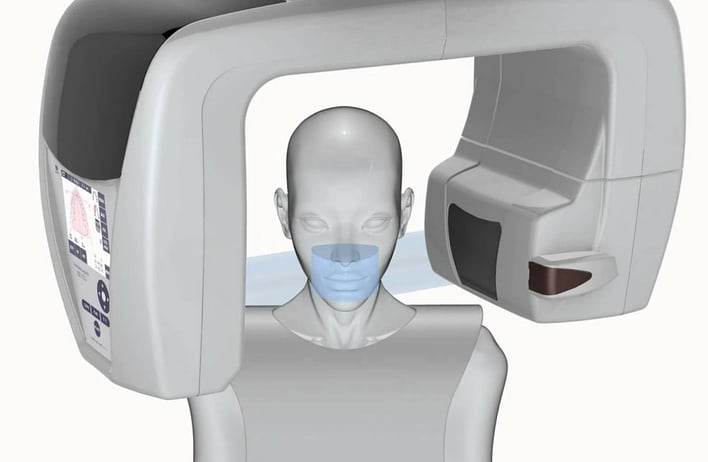 Tips for CBCT Positioning