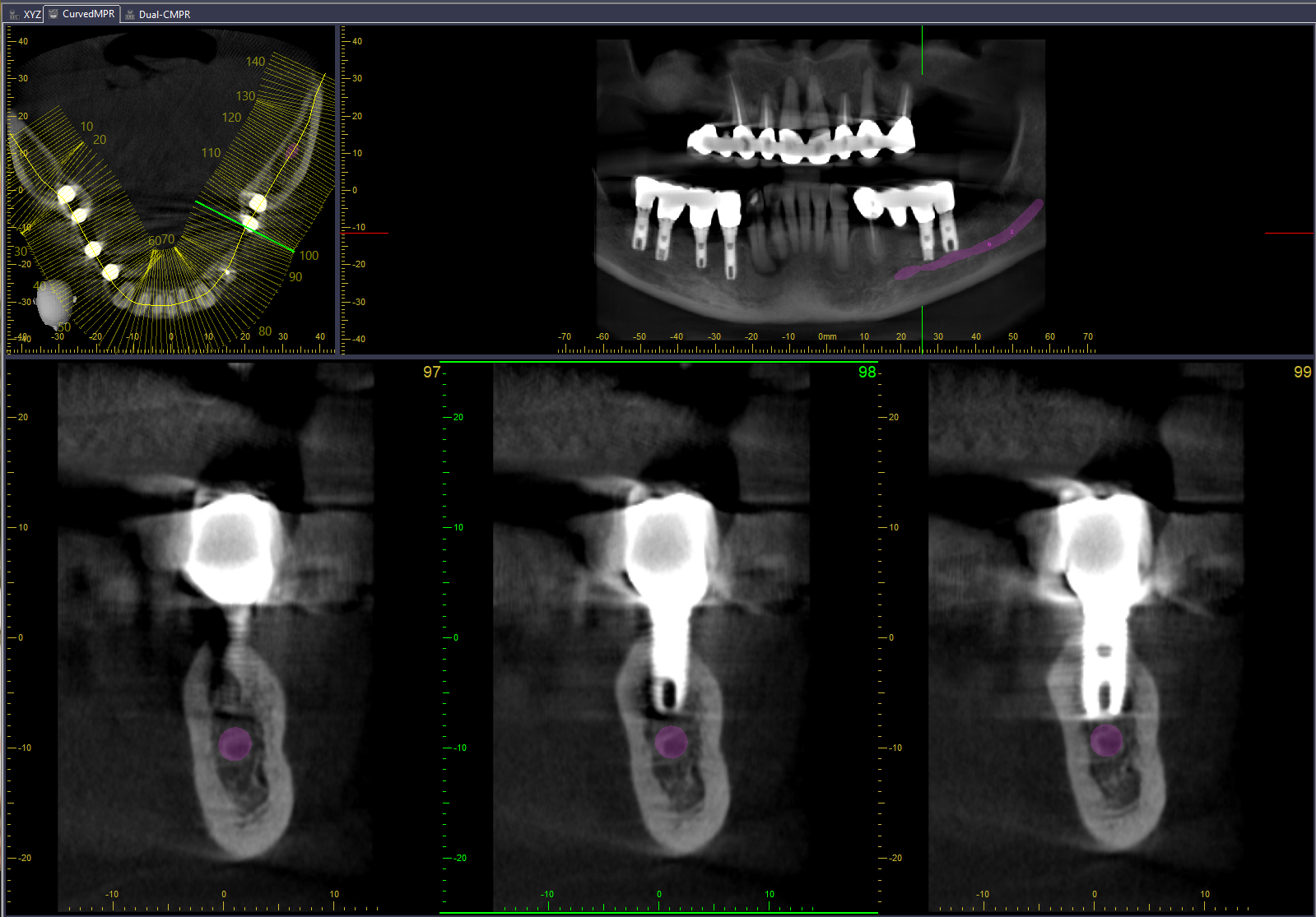 CBCT 101: 10 Fundamentals for Success